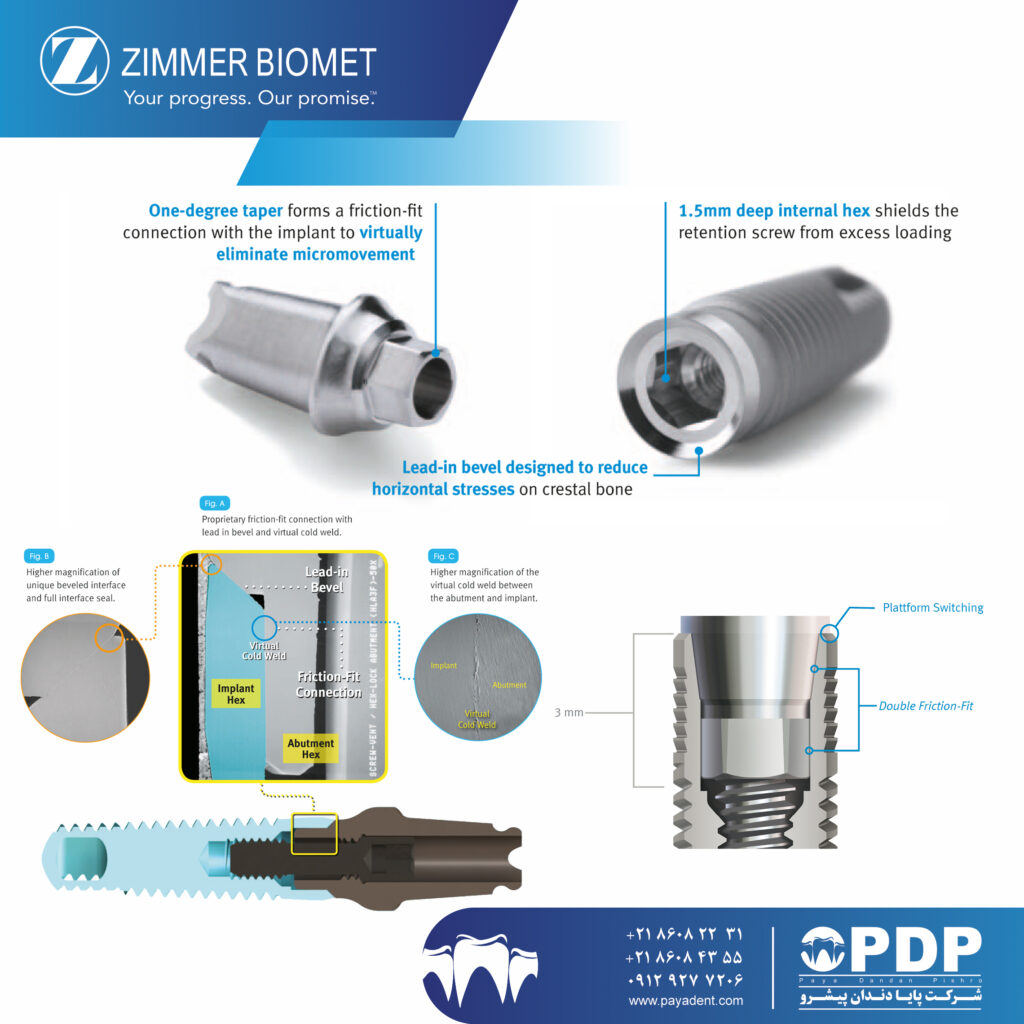 Zimmer Biomet Abutment’s particular connection – پایادنت